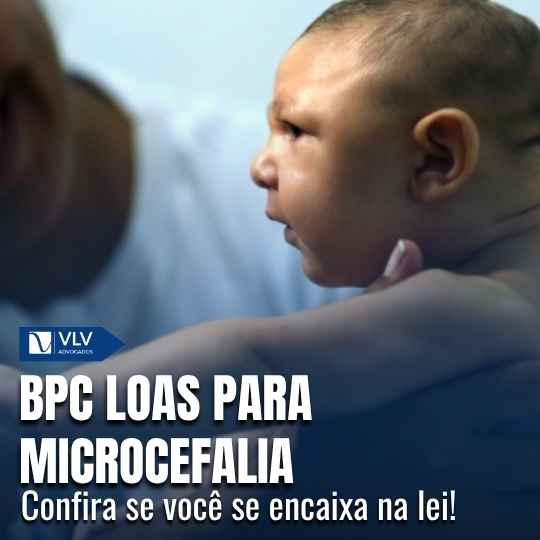 BPC LOAS para microcefalia: é possível? - VLV Advogados